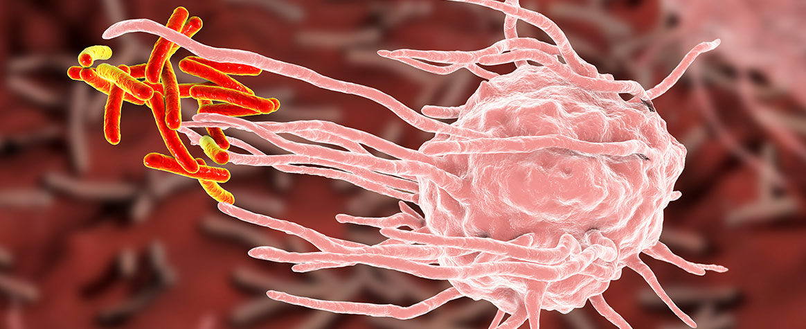 Avances En Fibrosis Pulmonar El Rol De Los Macrófagos En La Fpi