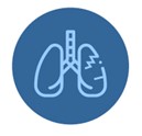 Fibrosis pulmonar idiopática (FPI) | Avances en Fibrosis Pulmonar
